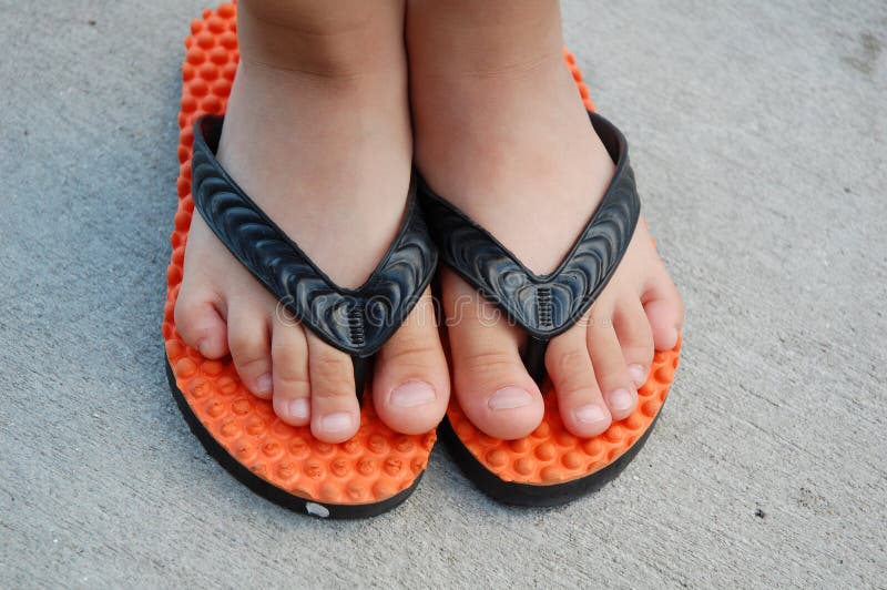 Children Foot with a Cracked and Peeling Toe Nail on the Largest Toe ...