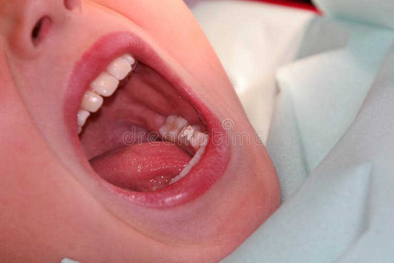 Children teeth stock photo. Image of mouth, health, open - 992066
