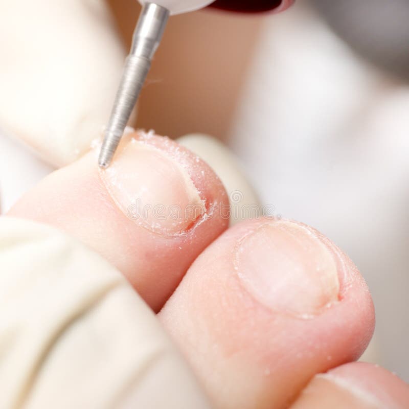 Chiropody stock image. Image of body, chiropody, pedicure - 31008975