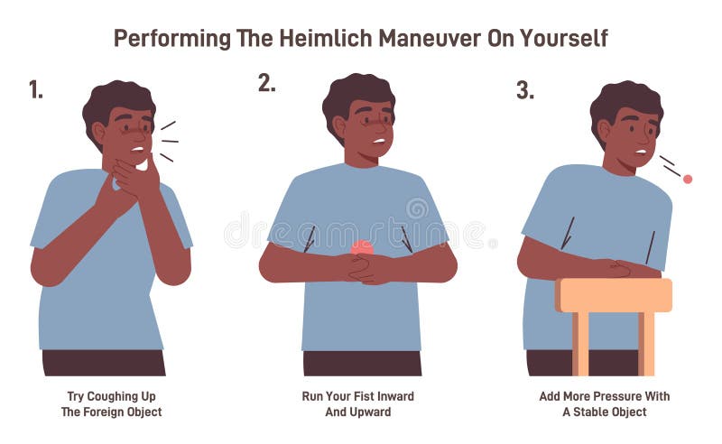 Heimlich Maneuver Instructions Heimlich Maneuver Instructions