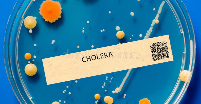 Cholera - Bacterial Infection that Causes Severe Diarrhea and ...