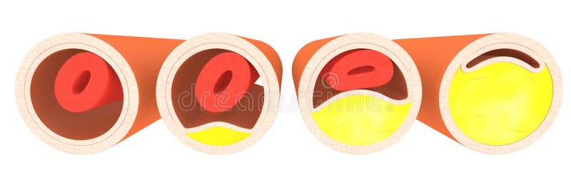 Cholesterol - 4 aders stock illustratie. Illustration of schip - 23855634