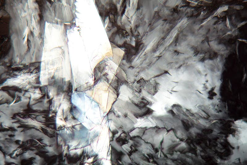 Cholesterol Crystals Under a Microscope Stock Photo - Image of ...