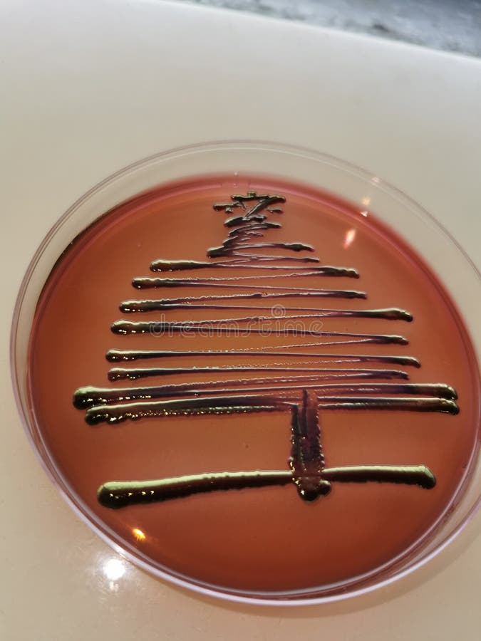 Christmas Tree Pattern of Escherichia Coli Stock Image - Image of ...