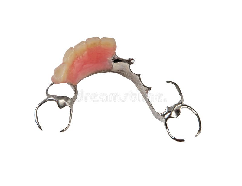 Chromium Removale Partial Denture Stock Image - Image of incisor ...