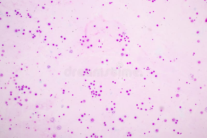 Chromosomes Human Under the Microscope. Stock Photo - Image of ...