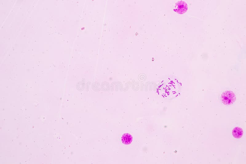 Chromosomes Human Under the Microscope. Stock Photo - Image of ...