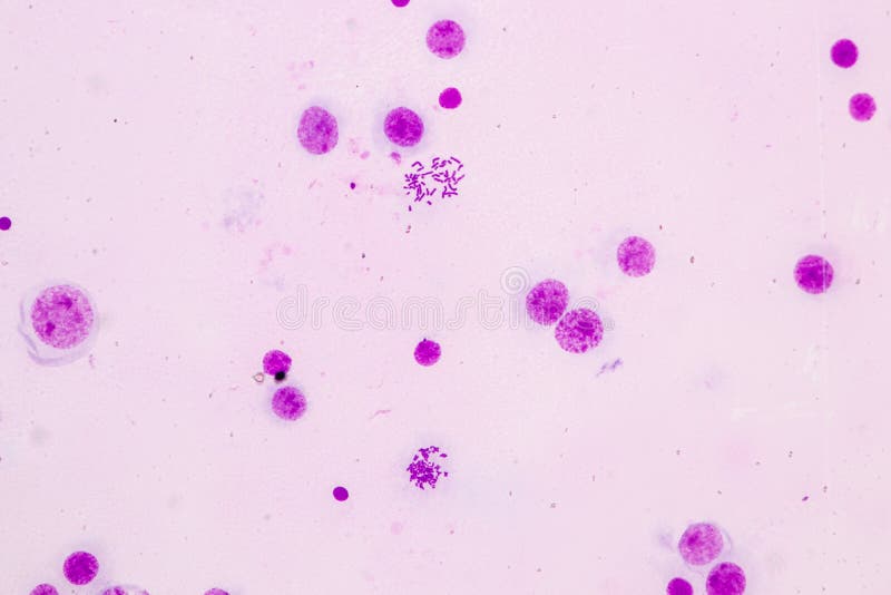 Chromosomes Human Under the Microscope. Stock Image - Image of ...