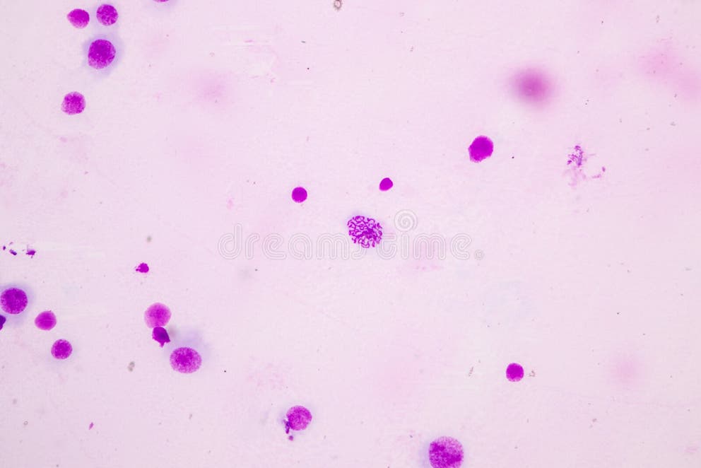 Chromosomes Human Under the Microscope. Stock Photo - Image of ...