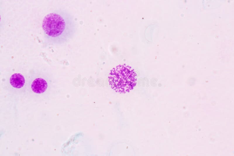 Chromosomes Human Under the Microscope. Stock Image - Image of ...