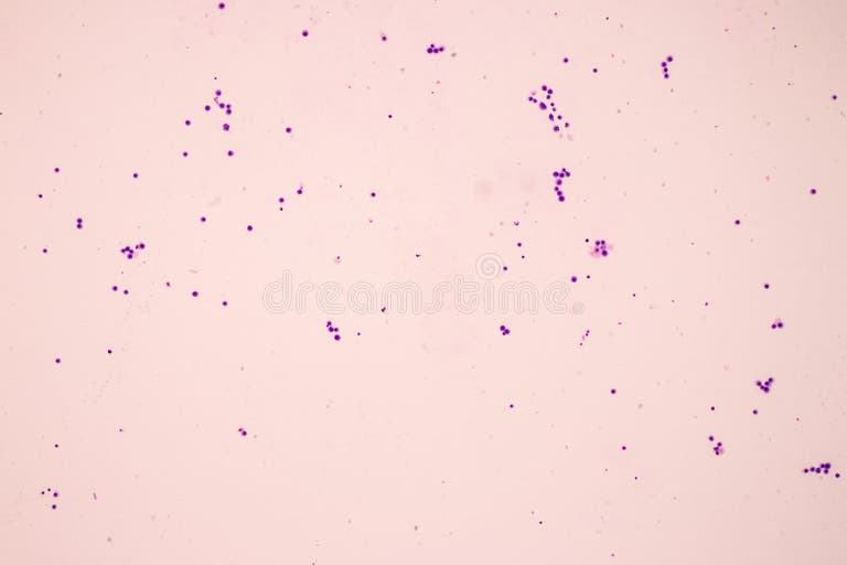 Chromosomes Human Under the Microscope. Stock Image - Image of cell ...