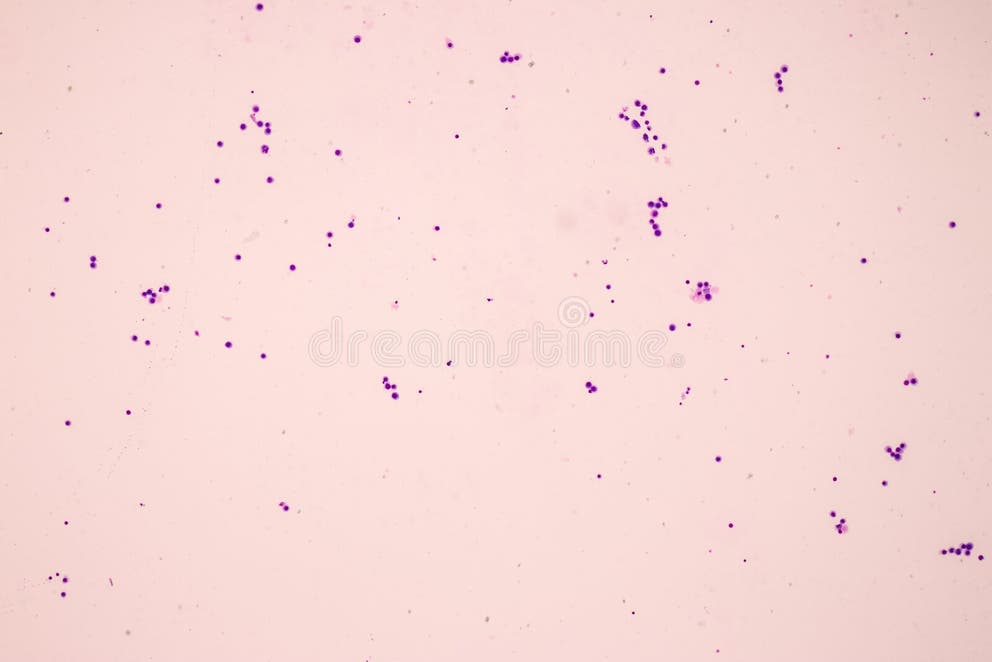 Chromosomes Human Under the Microscope. Stock Image - Image of cell ...