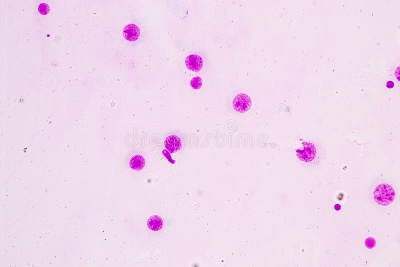 Chromosomes Human Under the Microscope. Stock Photo - Image of ...