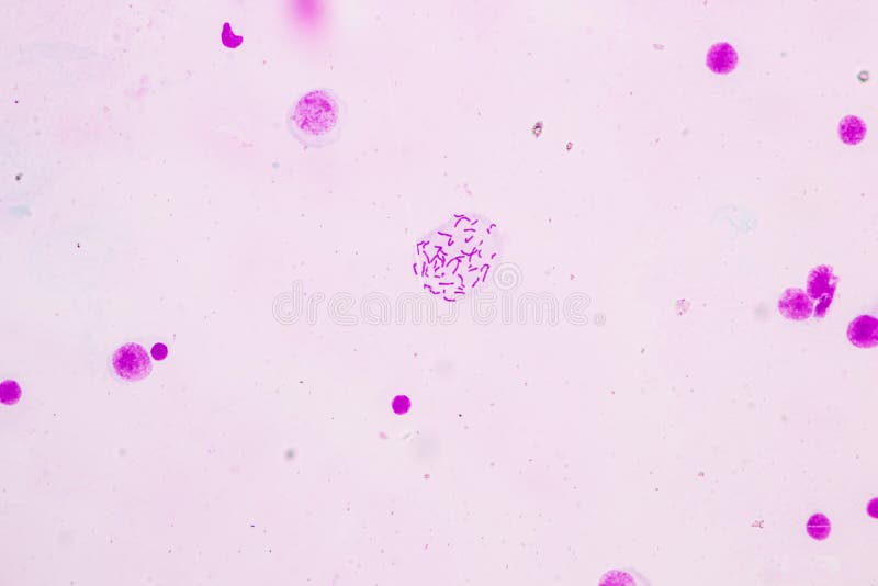 Chromosomes Human Under the Microscope. Stock Photo - Image of ...