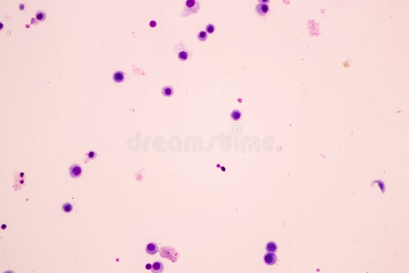 Chromosomes Human Under the Microscope. Stock Photo - Image of ...