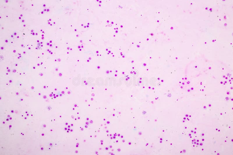 Chromosomes Human Under the Microscope. Stock Photo - Image of ...