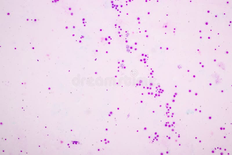 Chromosomes Human Under the Microscope. Stock Image - Image of genetic ...