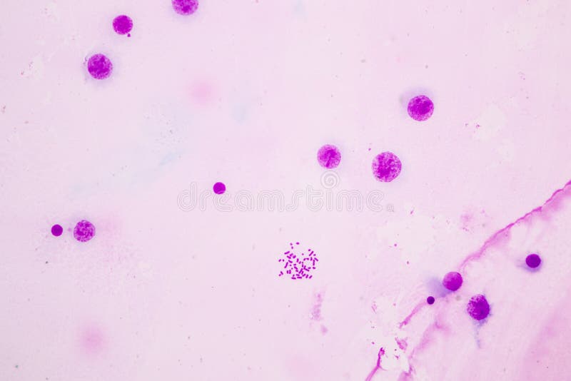 Chromosomes Human Under the Microscope. Stock Image - Image of ...