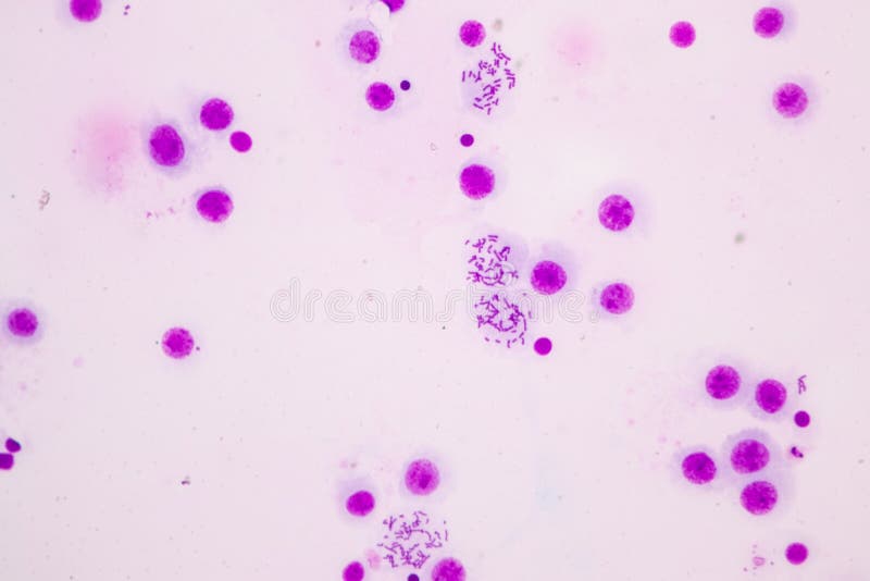 Chromosomes Human Under the Microscope. Stock Photo - Image of human ...