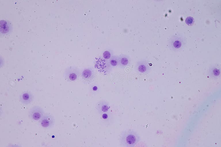 Chromosomes Human Under the Microscope for Education. Stock Photo ...