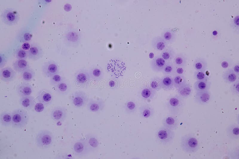 Chromosomes Human Under the Microscope for Education. Stock Image ...