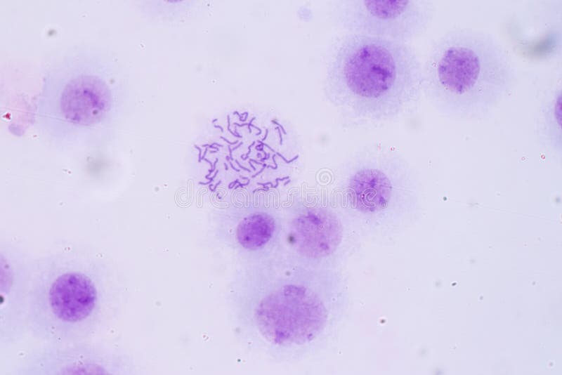 Chromosomes Human Under the Microscope for Education. Stock Photo ...