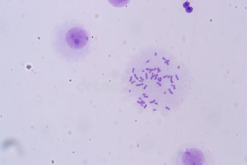 Chromosomes Human Under the Microscope for Education. Stock Photo ...