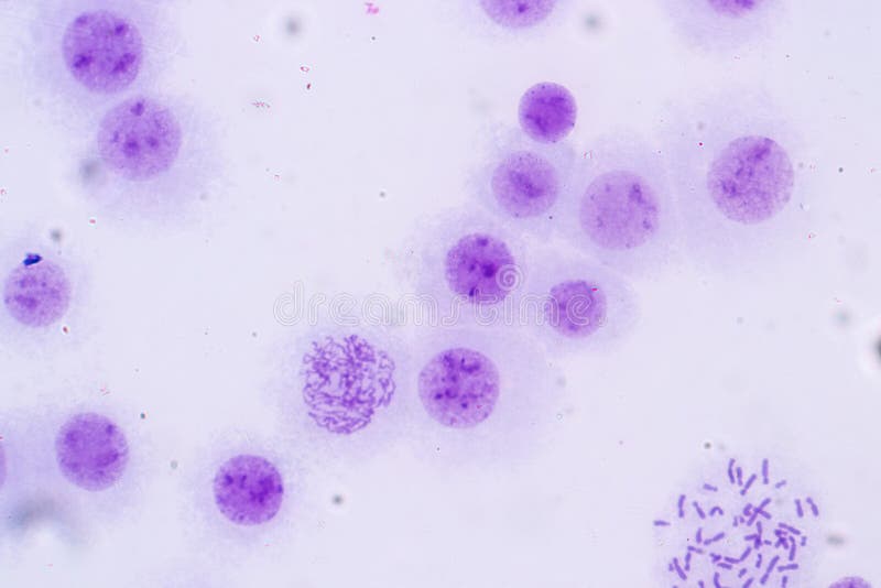 Chromosomes Human Under the Microscope for Education. Stock Photo ...