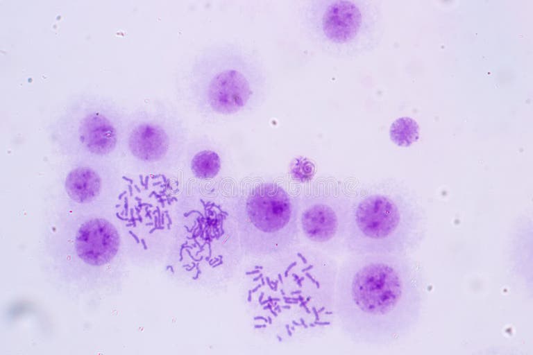 2,187 Chromosomes Ferm Stock Photos - Free & Royalty-Free Stock Photos ...