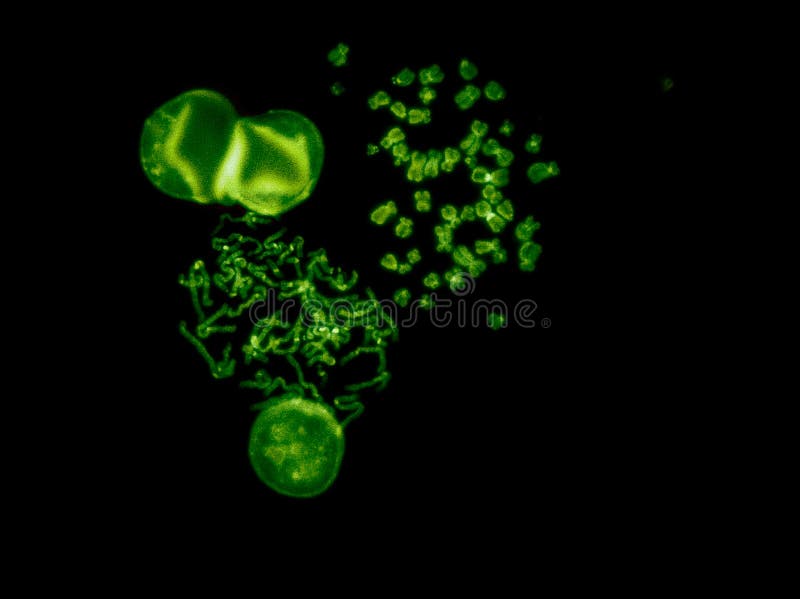 Chromosomes Under Fluorescence Microscope, Green Colored Human ...