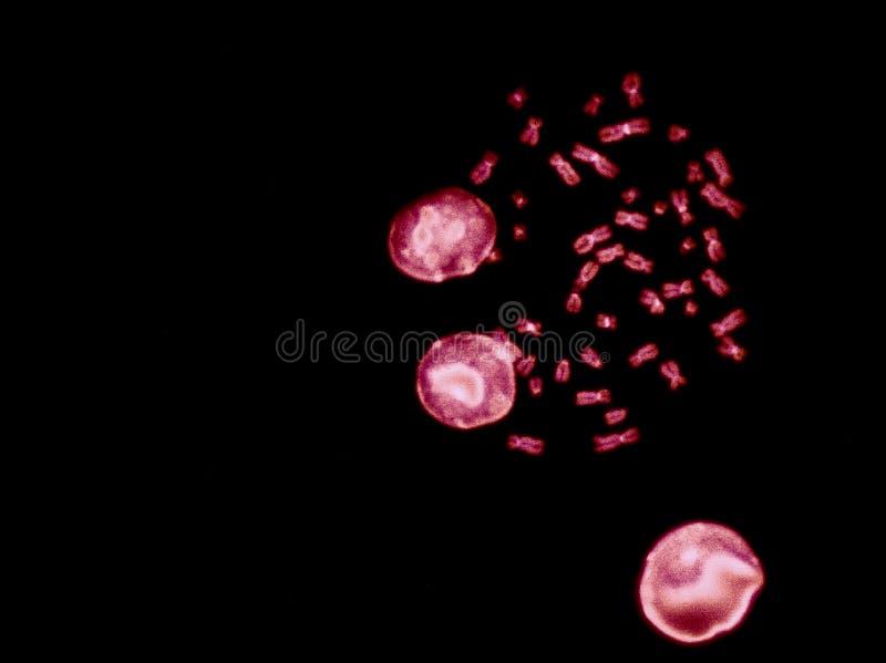 Chromosomes Under Fluorescence Microscope, Red Colored Human ...