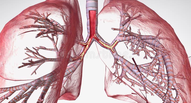 Chronic Bronchitis is a Long-term Respiratory Condition that Affects ...