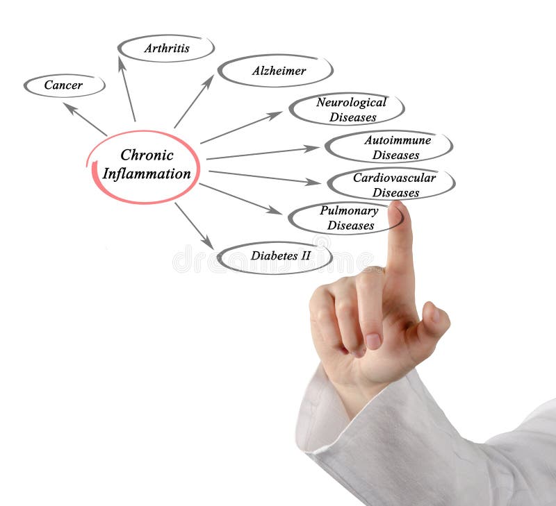 Chronic Diagram Inflammation Stock Photos - Free & Royalty-Free Stock ...