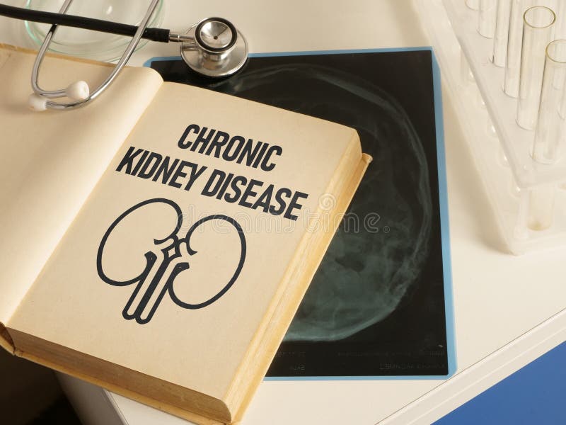 Chronic Kidney Disease CKD is Shown Using the Text Stock Photo - Image ...