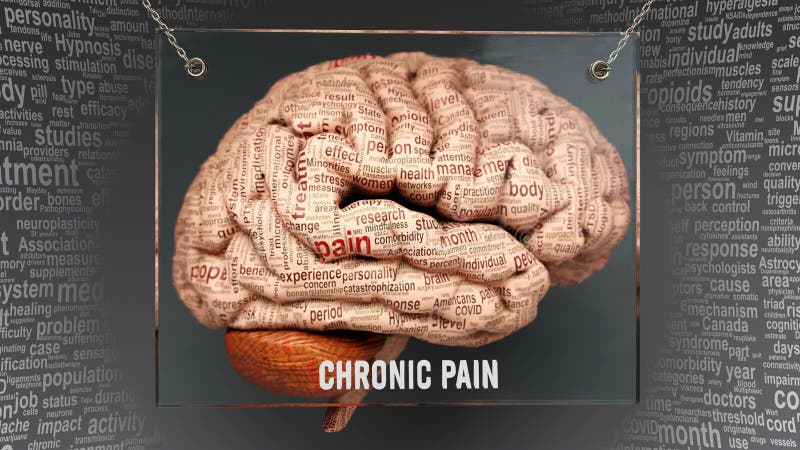 Chronic Pain in Human Brain Stock Photo - Image of pain, cortex: 247692202