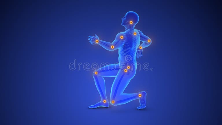 Acute Chronic Inflammation Stock Illustrations – 1,228 Acute Chronic ... Acute Chronic Inflammation Stock Illustrations – 1,228 Acute Chronic ...