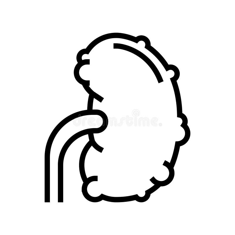 Chronic Pyelonephritis Color Icon Vector Illustration Stock Vector ...
