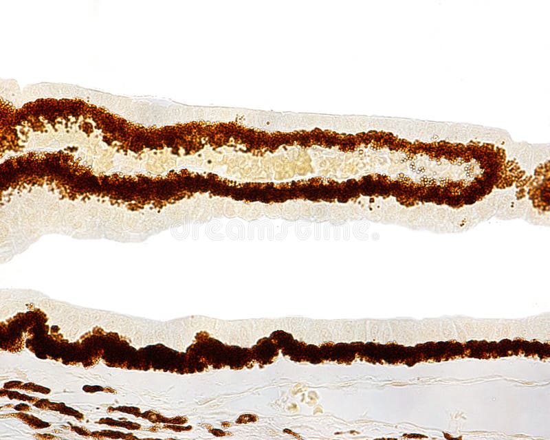 Eye. Ciliary Body Epithelium Stock Image - Image of light, process ...