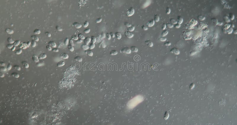Ciliates and Bacteria from Wastewater Move Under the Microscope Stock ...