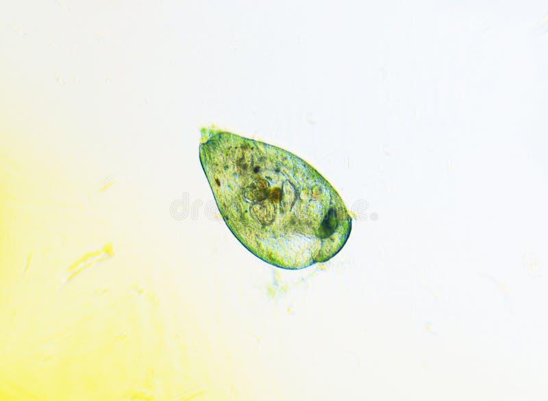 Stentor Under Microscope 400x