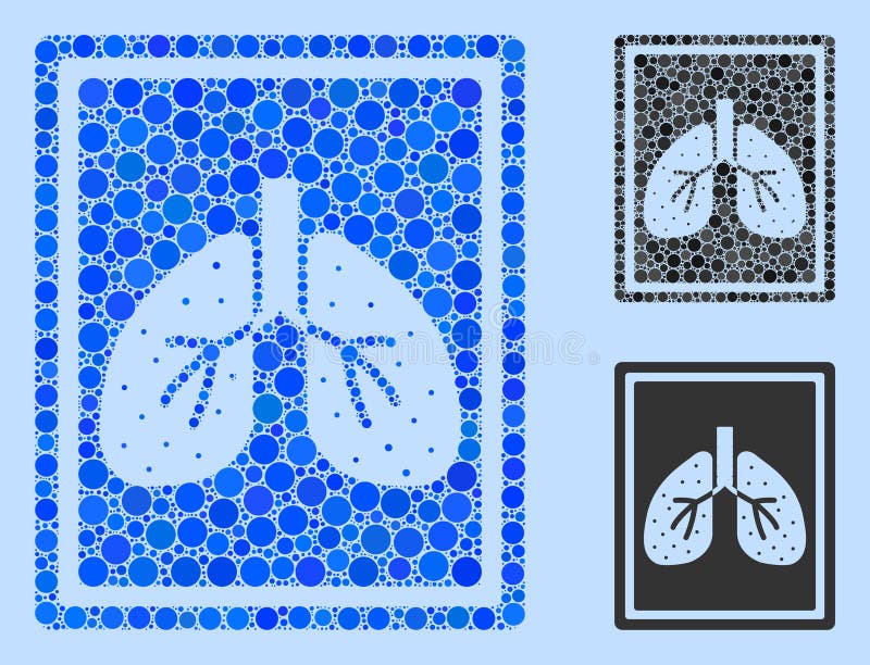 Circle Lungs Fluorography Icon Collage Stock Illustration ...