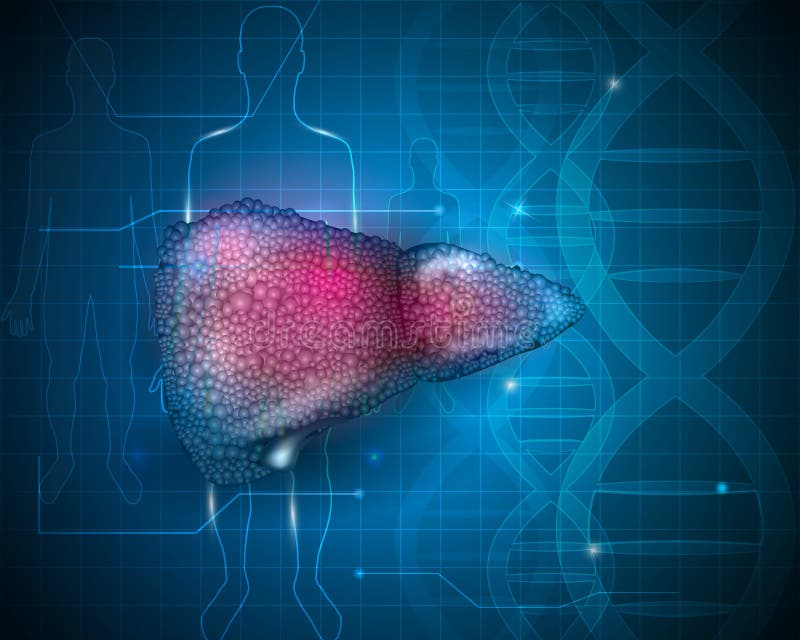 Cirrhose hépatique illustration de vecteur. Illustration du soin - 78796991