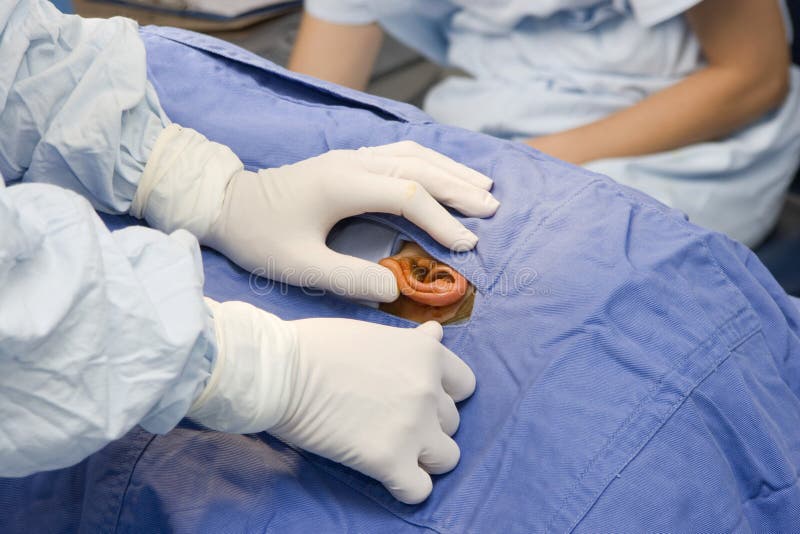 Cirugía del oído imagen de archivo. Imagen de fuentes - 24279723