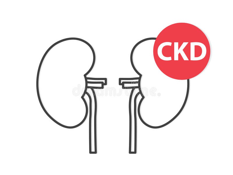 Chronic Kidney Disease Stock Illustrations – 1,023 Chronic Kidney ...