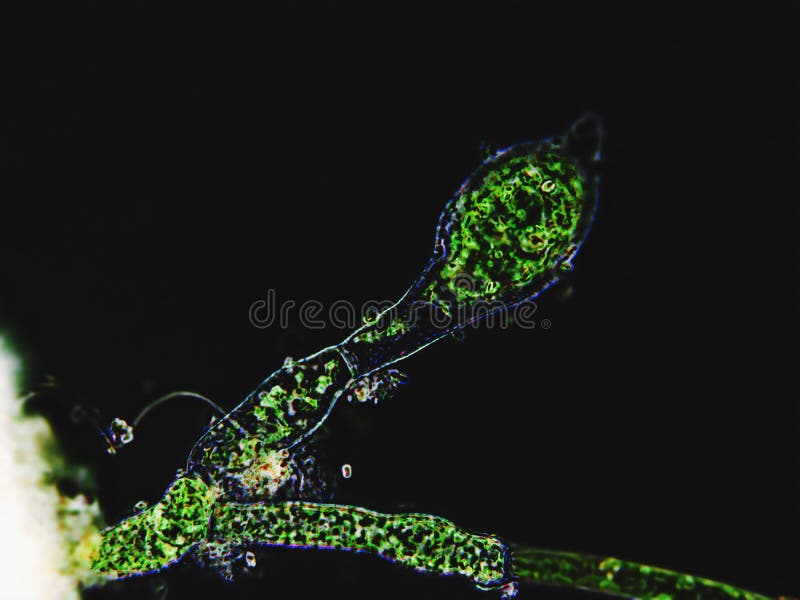 Cladophora Sp. Algae Under Microscopic View, Dark Background ...