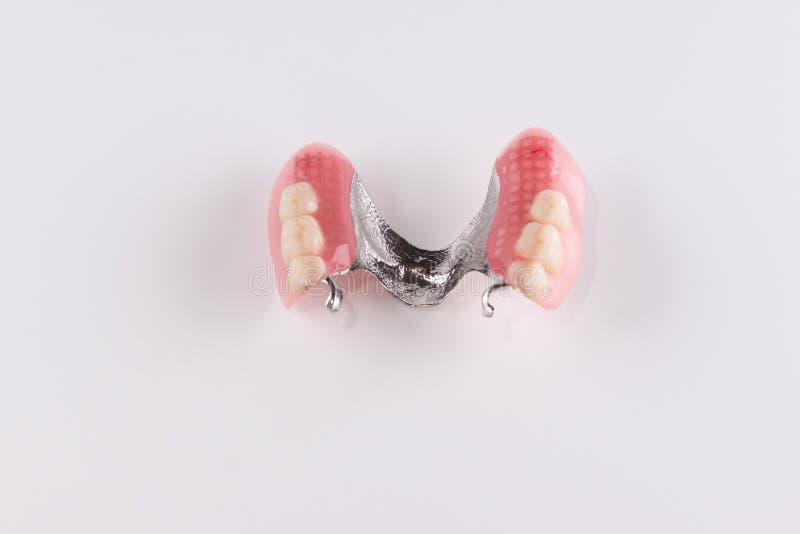 Clasp Prosthesis with Attachments Fixing Ceramic Crowns Stock Photo ...