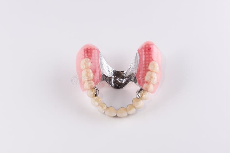 Clasp Prosthesis with Attachments Fixing Ceramic Crowns Stock Photo ...