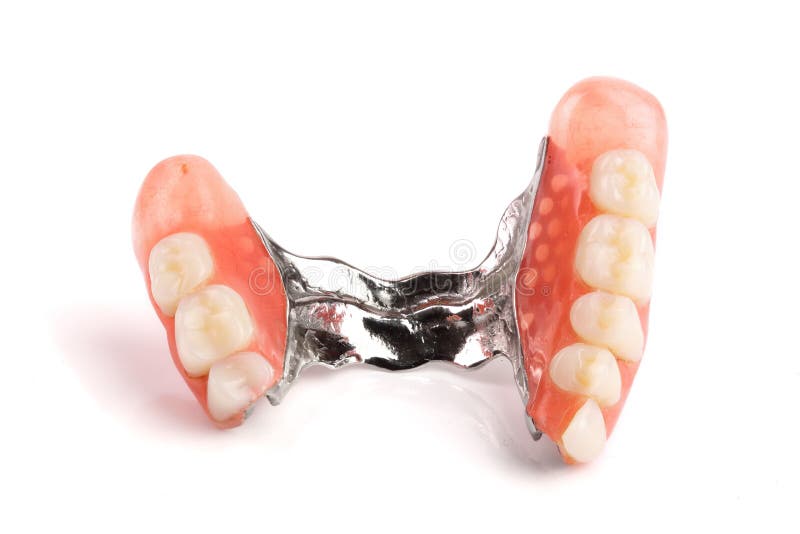 Clasp Prosthesis On The Lower Jaw Stock Image - Image of clasp ...