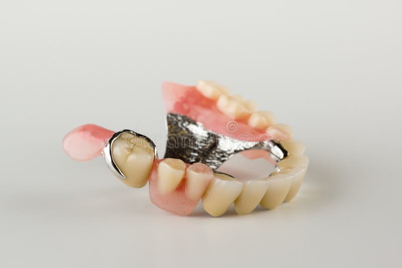Clasp Prosthesis with Lock Fixation Stock Image - Image of short, close ...