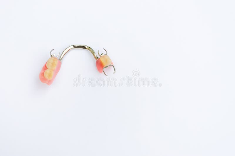 Clasp Prosthesis on the Lower Jaw Stock Photo - Image of healthcare ...